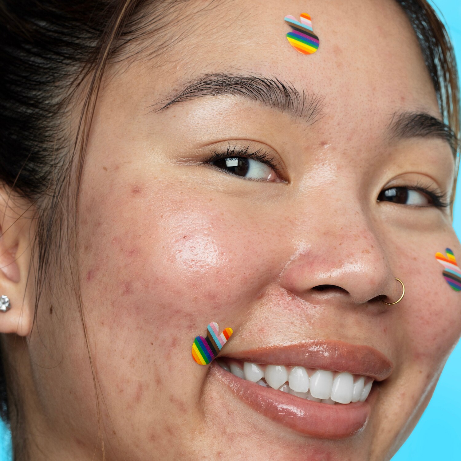 Pride Limited Edition-Sellos para el tratamiento del acné con ácido salicílico de Peace Out ...